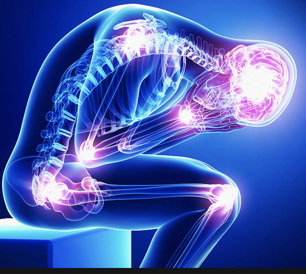 What Is The Relationship Between Back Pain And Disuse Syndrome?