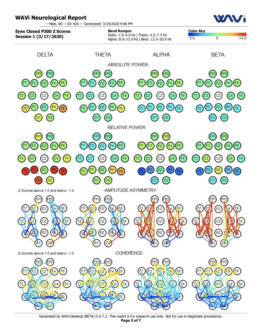 Traumatic Brain Injury Diagnosis and Treatment in Florida | TBI Help
